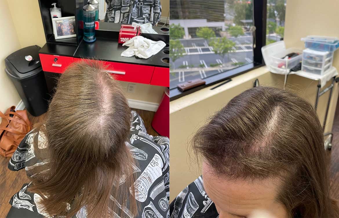 What Are Bonded Toppers? The Pros and Cons